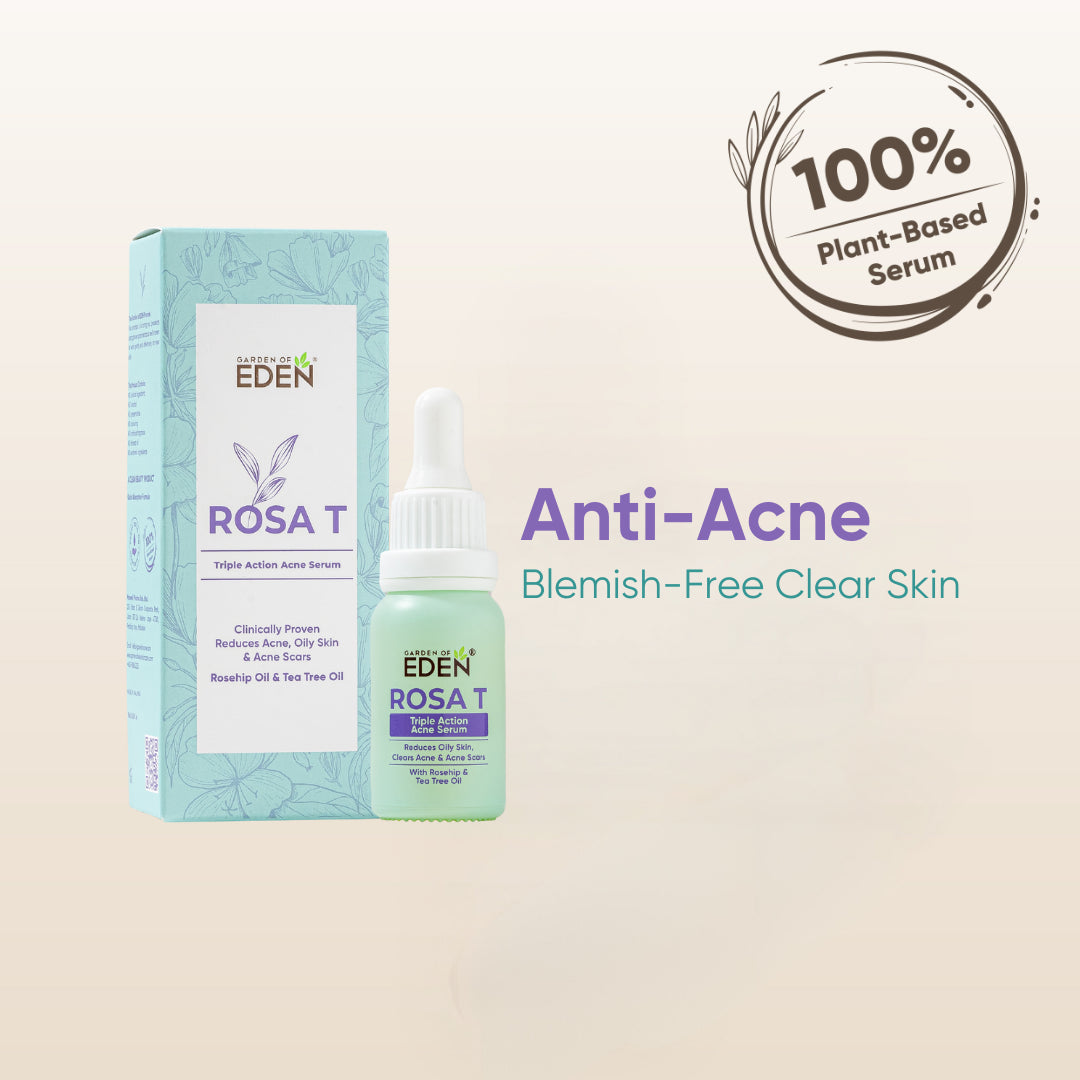 Rosa T Acne Serum 15ml – Garden of EDEN